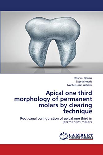 Apical one third morphology of permanent molars by clearing technique ...