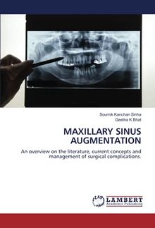 MAXILLARY SINUS AUGMENTATION: An overview on the literature, current ...