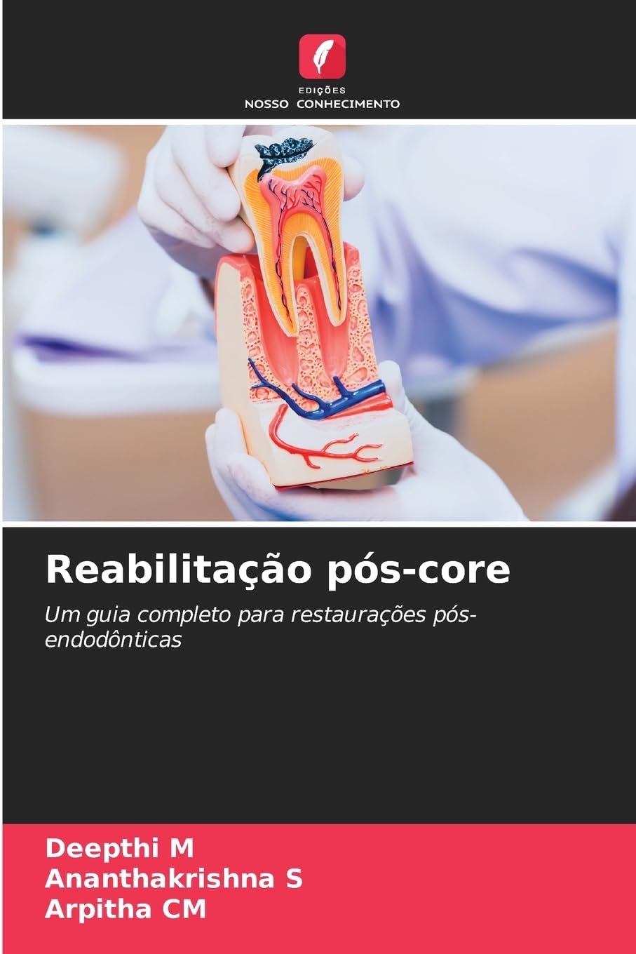 Reabilitação pós-core: Um guia completo para restaurações pós ...