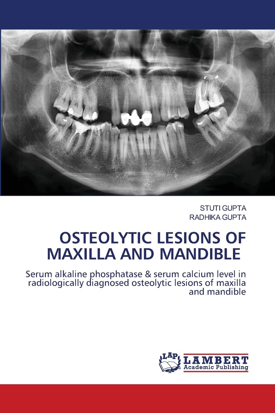 OSTEOLYTIC LESIONS OF MAXILLA AND MANDIBLE: Serum alkaline phosphatase ...