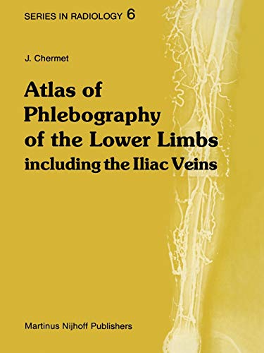 Atlas of Phlebography of the Lower Limbs: Including the Iliac Veins ...
