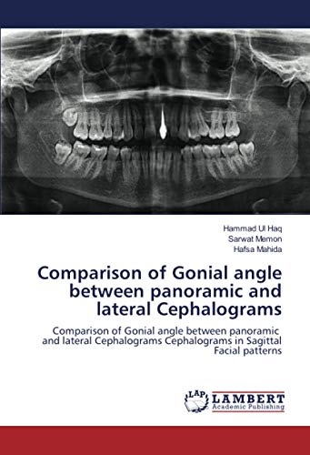 Comparison of Gonial angle between panoramic and lateral Cephalograms ...